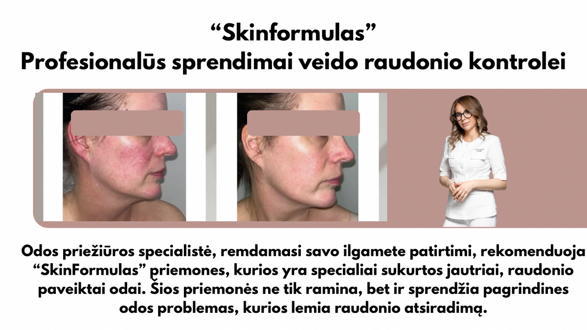 Kaip sumažinti veido odos raudonį? | SKINBIO.lt